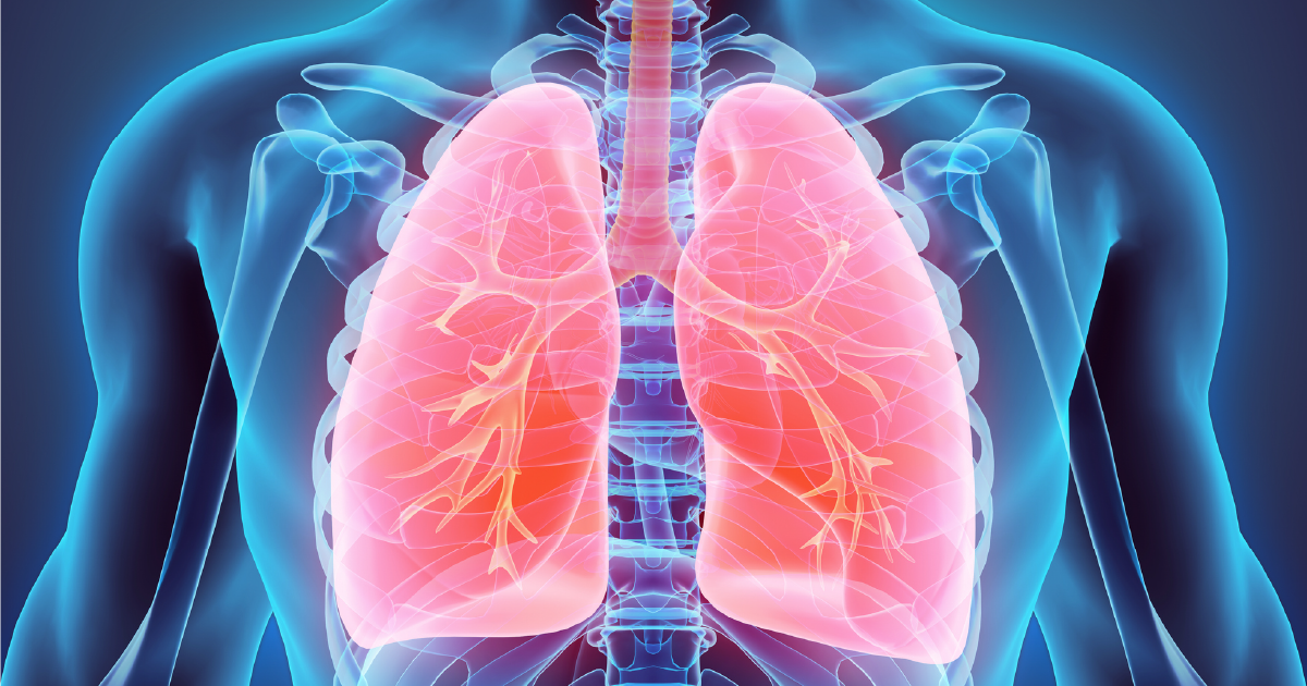 Pulmonary Embolism Explained: Symptoms, Diagnosis, Treatment