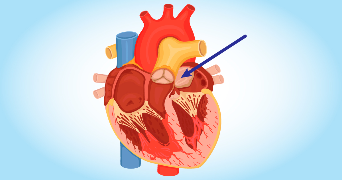 Can You Get Heart Cancer? It's Rare, but Yes. Learn the Symptoms